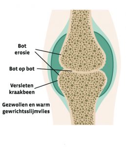 Gewrichten | basiskennis - Synopet | De vloeibare standaard in ...