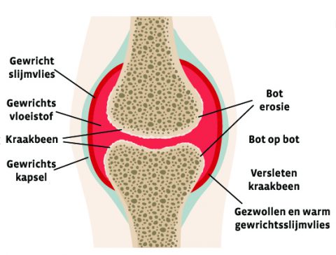 Gewrichten | basiskennis - Synopet | De vloeibare standaard in ...